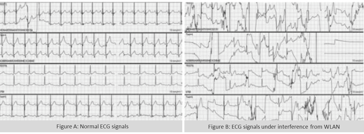 The Wireless ECG Monitoring System Can Help You Understand The ...